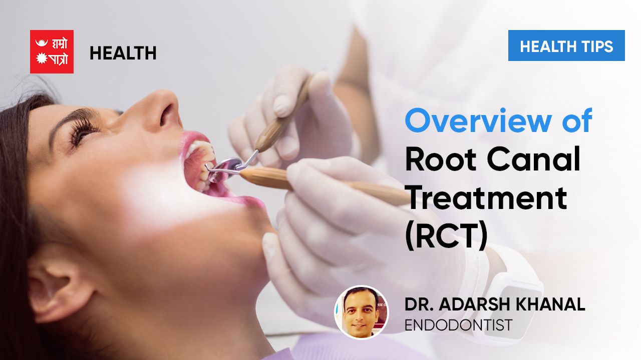Overview of root canal treatment (RCT) | Hamro Patro
